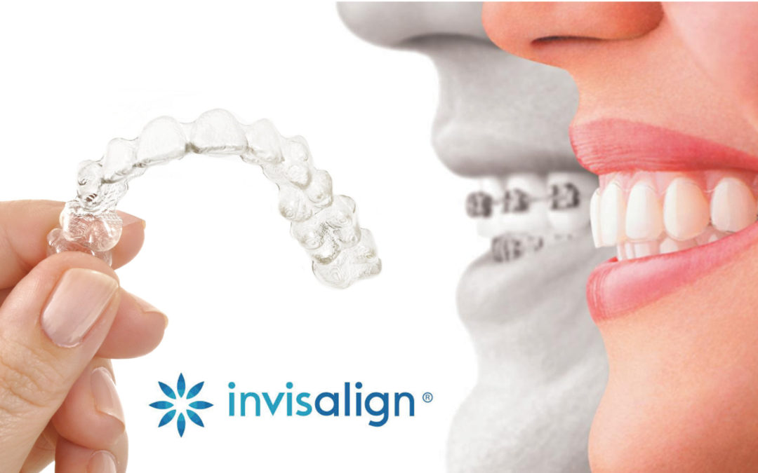 brackets invisibles - Dentistas con tratamientos Invisalign - Oklahoma