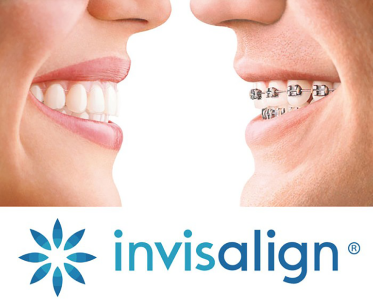 Invisalign OKC - Invisalign and Clear Braces Treatment Oklahoma