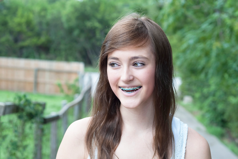 Orthodontic Lifetime Maximum -- What Is It and How Does It Work?